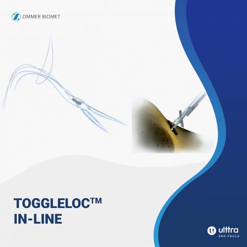 Botão ajustável Toggleloc™ In-Line com tecnologia ZipLoop™ - Ulttra